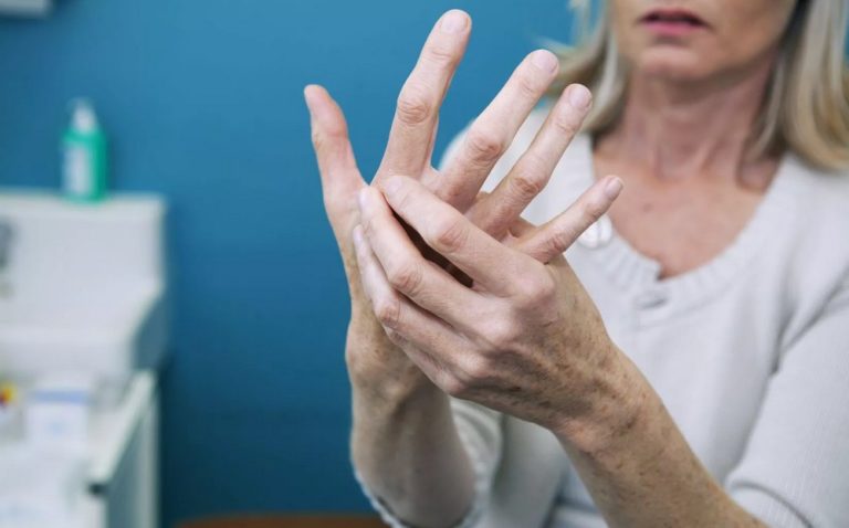 Savez-vous ce qu’est l’arthrose des doigts ? – Gurret.fr